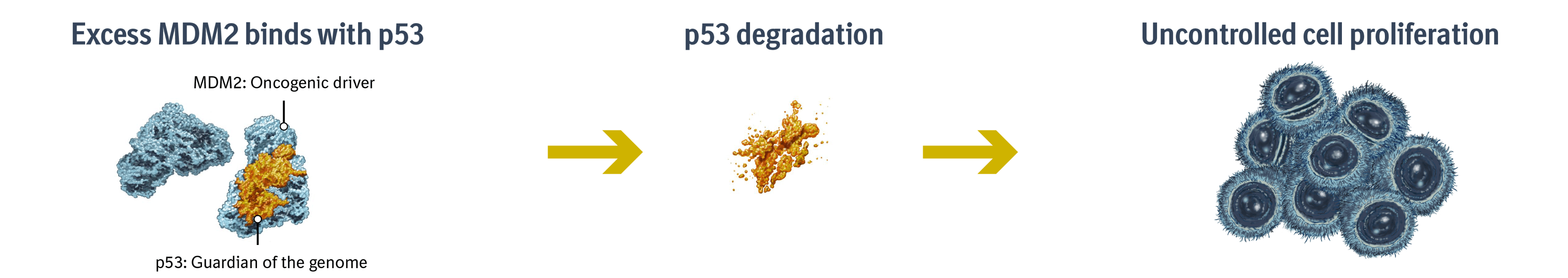 Understanding Dedifferentiated Liposarcoma (DDLPS cancer)